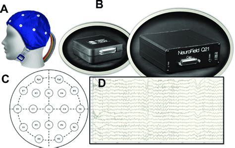 EEG Data Acquisition A A Channel EEG Cap From Electro Cap Download Scientific Diagram