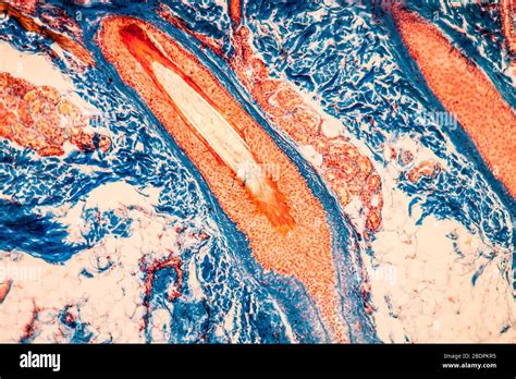 Scalp With Hair Roots Tissue Under The Microscope X Stock Photo Alamy