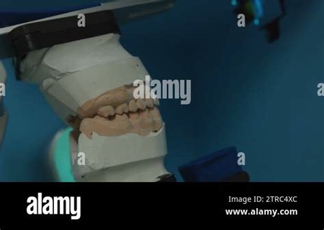 Maxillary Denture Stock Videos And Footage Hd And 4k Video Clips Alamy