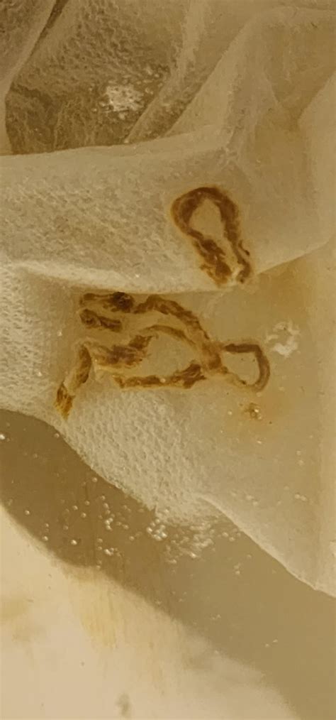 Page 315 Any Ideas On What These Are Rparasites
