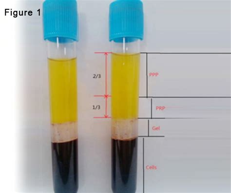 Concepts And Applications Of Prp Cpt And Prf Concepts And Applications Of Prp Cpt And Prf