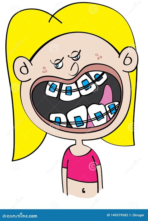 Girl With Braces Vector Illustration 4510684