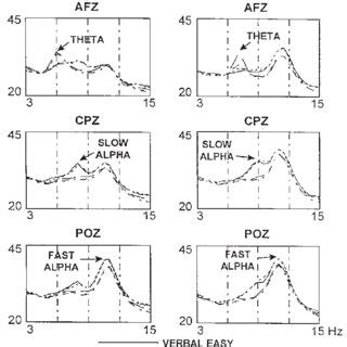 Average EEG Spectra Over The 3 15 Hz Interval For Each Task Condition Download Scientific