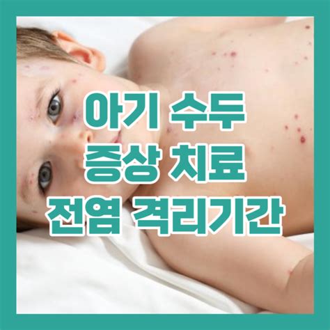 아기 수두 증상 치료 전염성 격리기간 정리 네이버 블로그