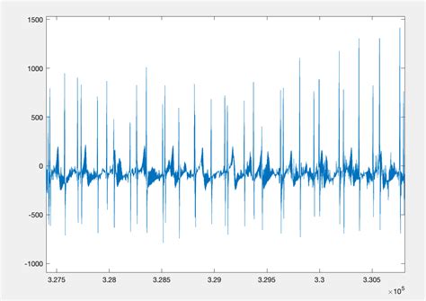 Multiple Ecgdata At One Timestamp · Issue 387 · Polarofficialpolar Ble Sdk · Github