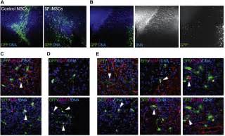 Direct Reprogramming Of Fibroblasts Into Neural Stem Cells By Defined Factors Cell Stem Cell