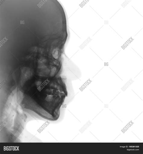 Human Skull Right Side View