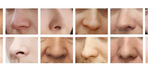 Different Nose Types
