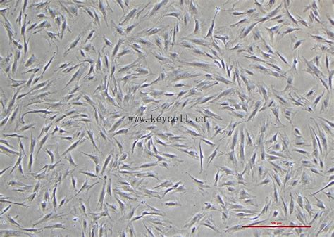 人风湿性关节滑膜成纤维细胞永生化 Hfls Ra 细胞系 细胞库 旗赛生物科技（武汉）有限公司