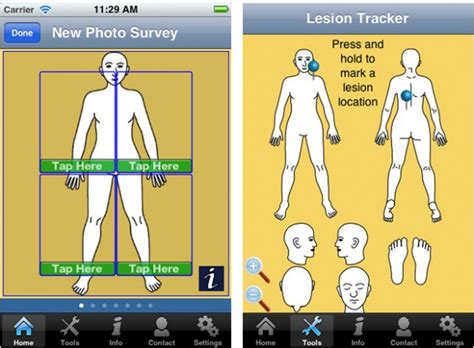 Take Nude Pictures Of Yourself And This IPhone App Will Tell You If You Have Cancer Cult Of Mac