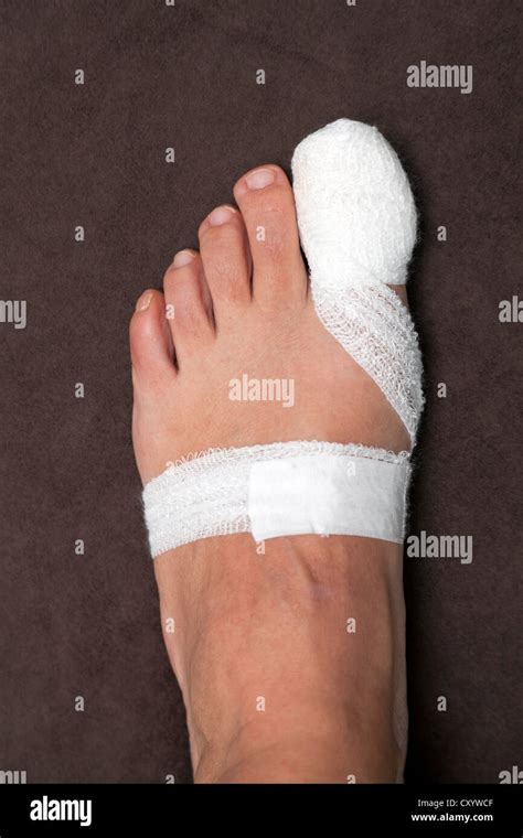 Bandaged Toe Images At Troy Musselman Blog