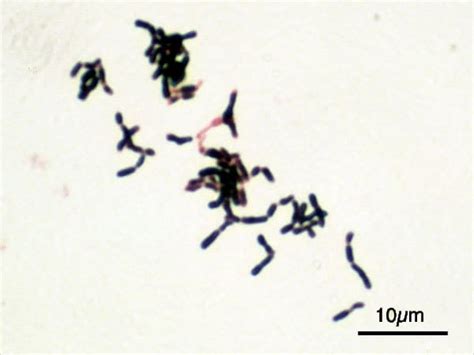 Bifidobacterium Adolescentis Jcm 1275