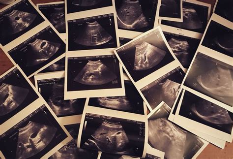 Ultrasound Technician Ultrasound Technician Ultrasound Tech Ultrasound