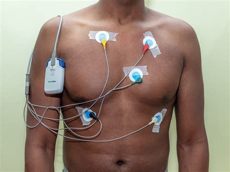 Holter And Event Monitoring Capitol Cardiology Associates