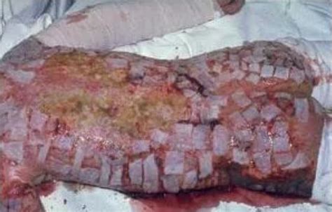 Hisashi Ouchi Real Photo No Blur And Details Of The Incident