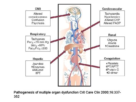 Multiple Organ Dysfunction Syndrome Definition Diagnosis Management