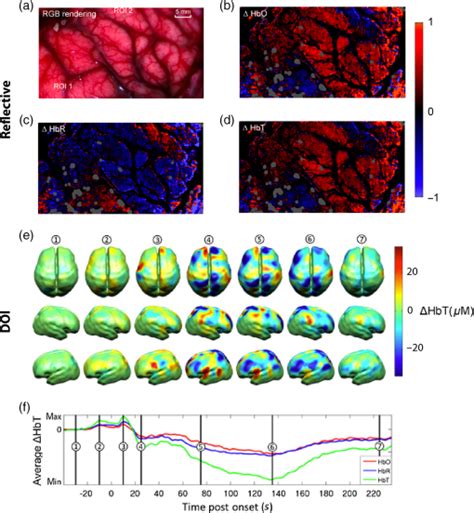 Noninvasive Hemoglobin Sensing And Imaging Optical Tools For Disease Diagnosis