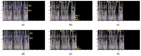 Detecting Deepfake Voice Using Explainable Deep Learning Techniques