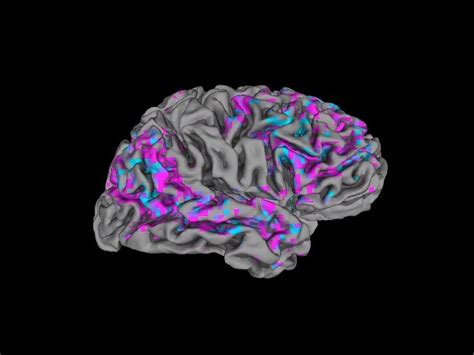 Experts Use Fmri And Ai To Decode Language Signals In The Brain Photographs