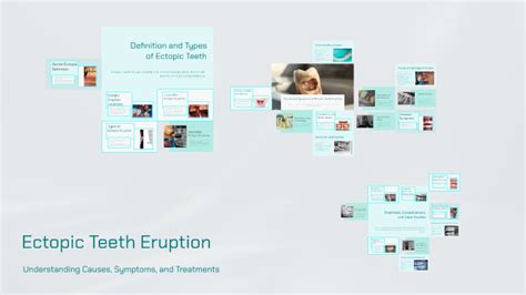 Ectopic Teeth Eruption By Ghada Abdulla On Prezi