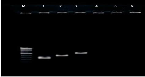 Figure 2 From Pathogenic Vibrio Parahaemolyticus Detection Through PCR
