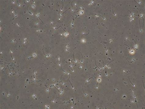 Maria Rinti On Linkedin Sex Selection Without Embryo Selection For Non Medical Reasons