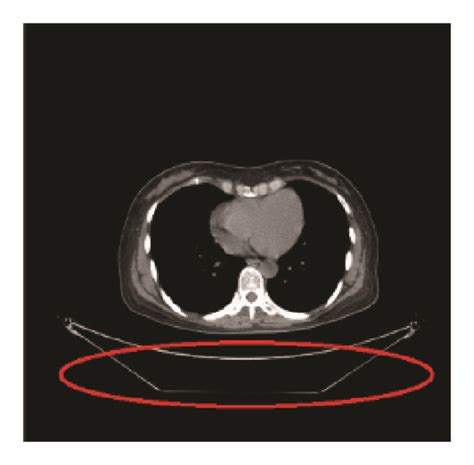 An Example Of Ct Preprocessing Results A The Source Ct Image B
