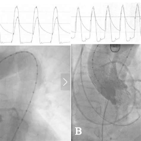 Auxiliary Examinationsbefore And After Tavi Download Scientific Diagram