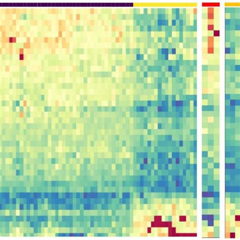 Transcriptome Profiling Confirmed The Correct Diagnosis Of Cases With