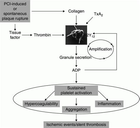 Light Transmission Aggregometry Thoracic Key