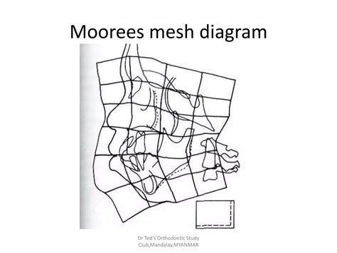 Practical Cephalometric Tracing Pptx