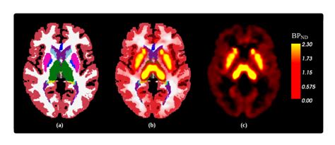 A Segmentation Of Subcortical Regions In Freesurfer B Segmentation
