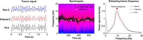 Tremor Signal Processing And Tremor Frequency Extraction The Left Download Scientific Diagram