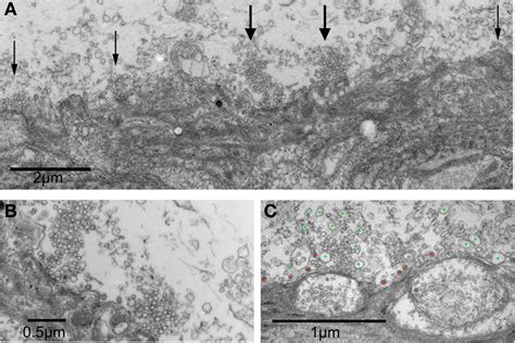 Electronmicrographs Of A Synaptic Junctions Following Rns60 Asw