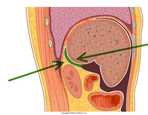 Efast Exam Flashcards Quizlet
