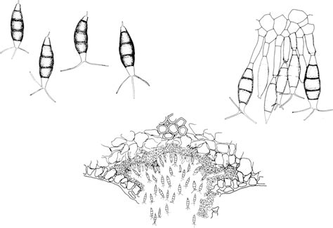 19 A Vertical Section Of An Acervulus B Mature Conidia And C