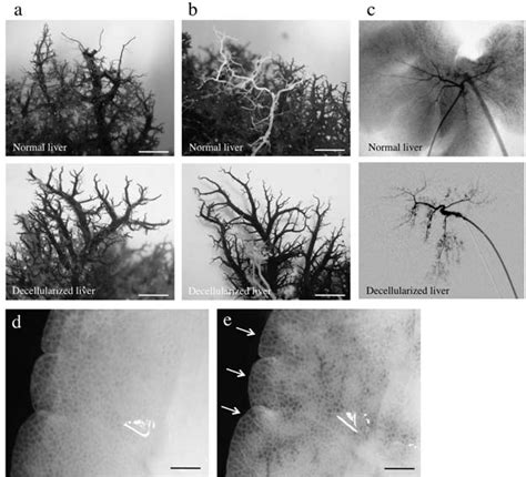 Decellularized Liver Matrix Preserves Entire Vascular System And Bile Download Scientific