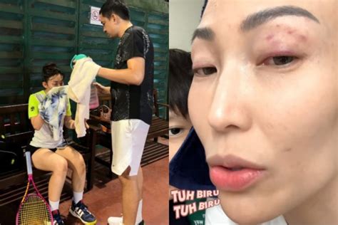 9 Potret Insiden Mata Ayu Dewi Kena Bola Tenis Suaminya