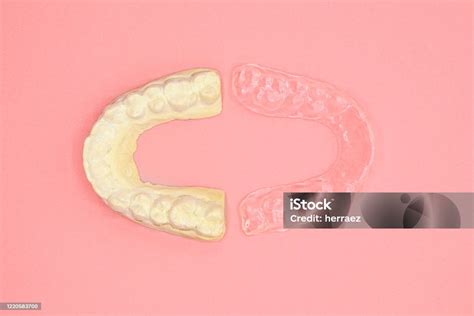 치과 석고 금형 및 치열 교정 실리콘 트레이너 분홍색 배경에 치과 교정을위한 모바일 치열 교정 기기 건강관리와 의술에 대한 스톡