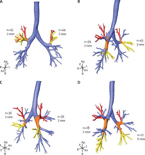 Segmental Bronchi
