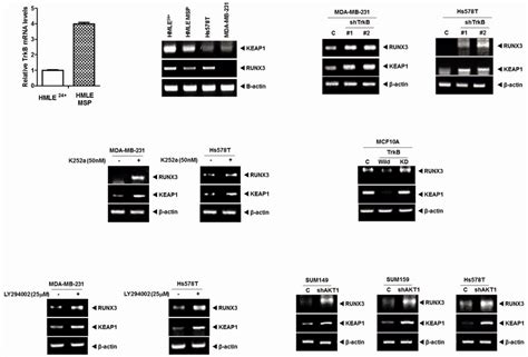 Trkb Represses Runx3 And Keap1 Expression Through Akt Activation A
