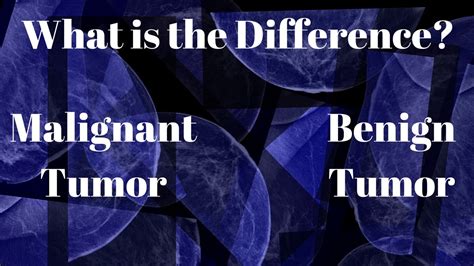 Malignant Tumor Vs Benign