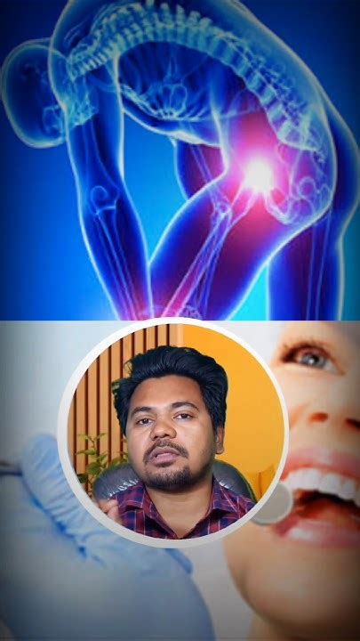 টক দই খাবার উপকারিতা। Benefits Of Eating Sour Yogurt Youtube