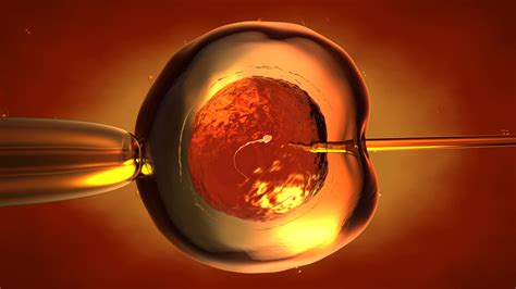 Un Médico Holandés Especialista En Fertilidad Usó Su Propio Esperma Para Engendrar Al Menos 21