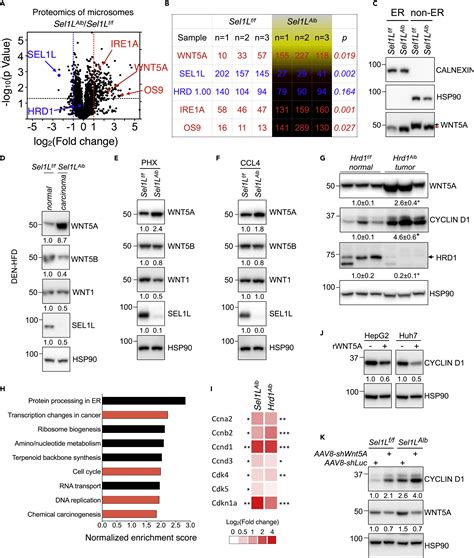 Sel1l Hrd1 Er Associated Degradation Suppresses Hepatocyte Hyperproliferation And Liver Cancer