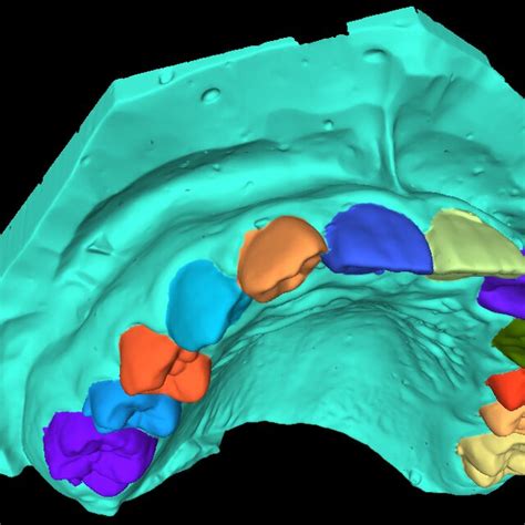 Examples From Our Dataset Of Ground Truth Teeth Geometries Teeth Download Scientific Diagram