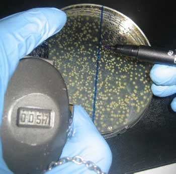 What Does CFU Stand For Is Higher Or More Probiotic CFU S Better