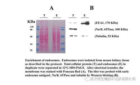 【评测】内体和细胞组分分离试剂盒 Minutetm
