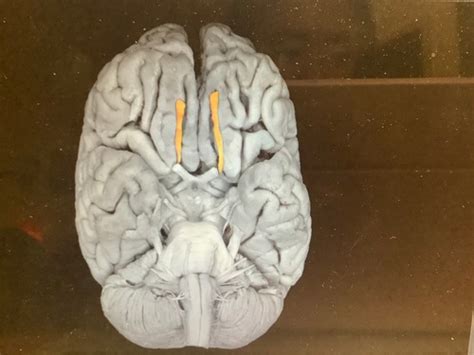 Cranial Nerves Flashcards Quizlet