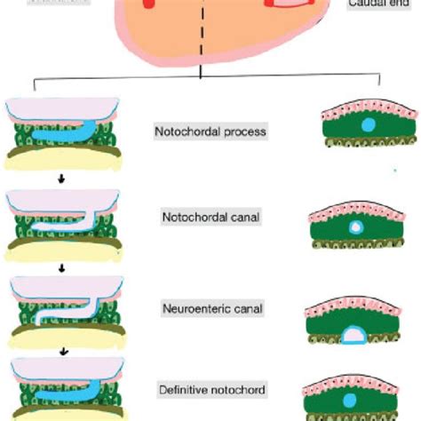 Stages Of Secondary Neurulation Beginning Just As The Posterior Download Scientific Diagram